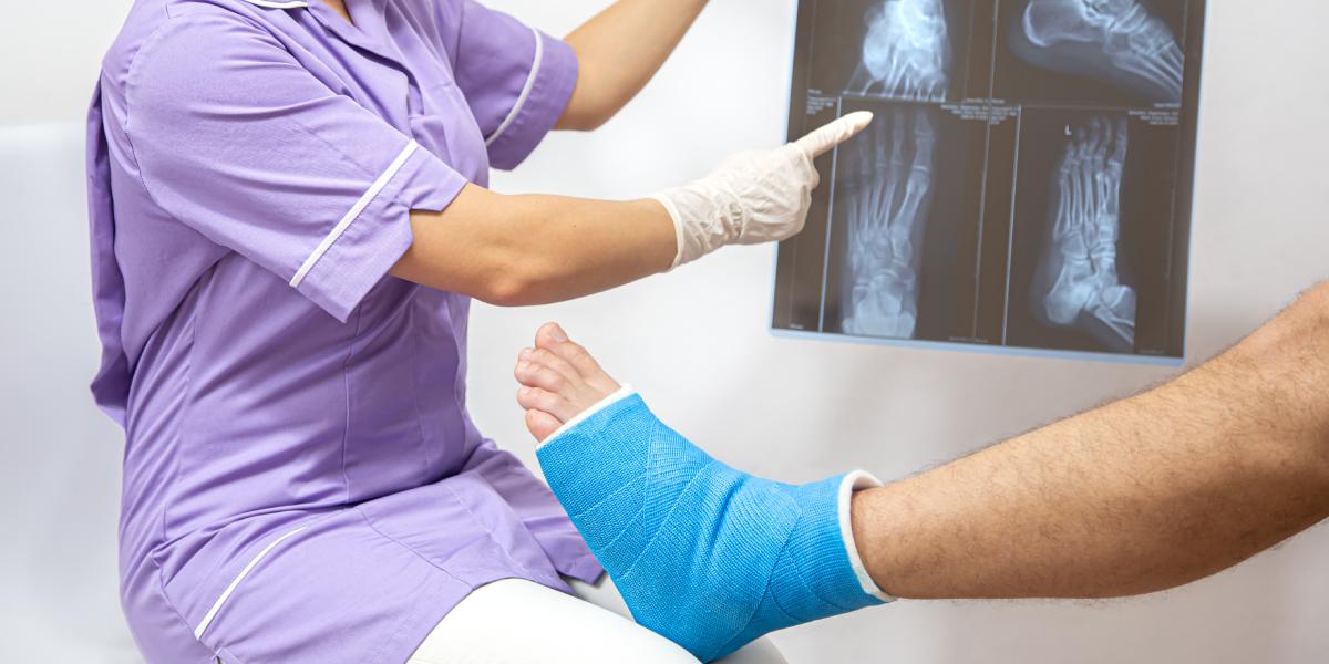 ¿Qué es la luxación y subluxación? - Grupo Amla